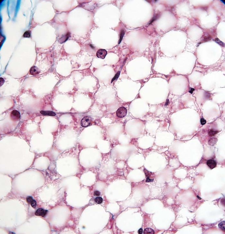 La diversité des tissus conjonctifs adipeux | Codex virtualis