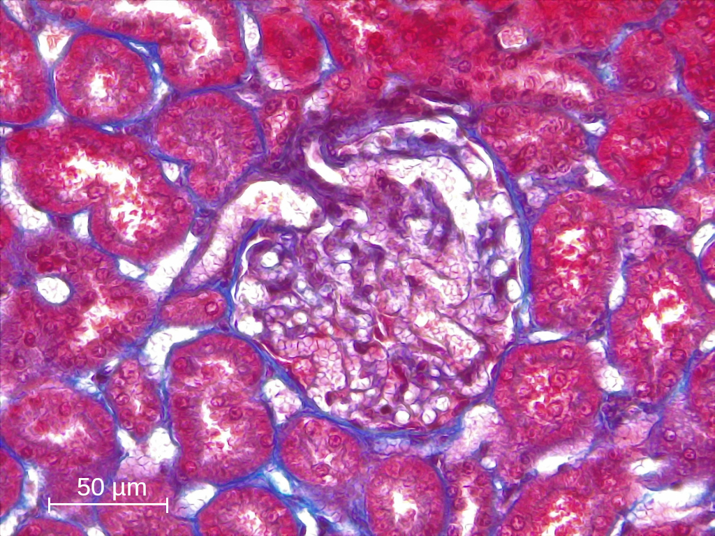 Corpuscule de Malpighi de rein de Mammifère | Codex virtualis